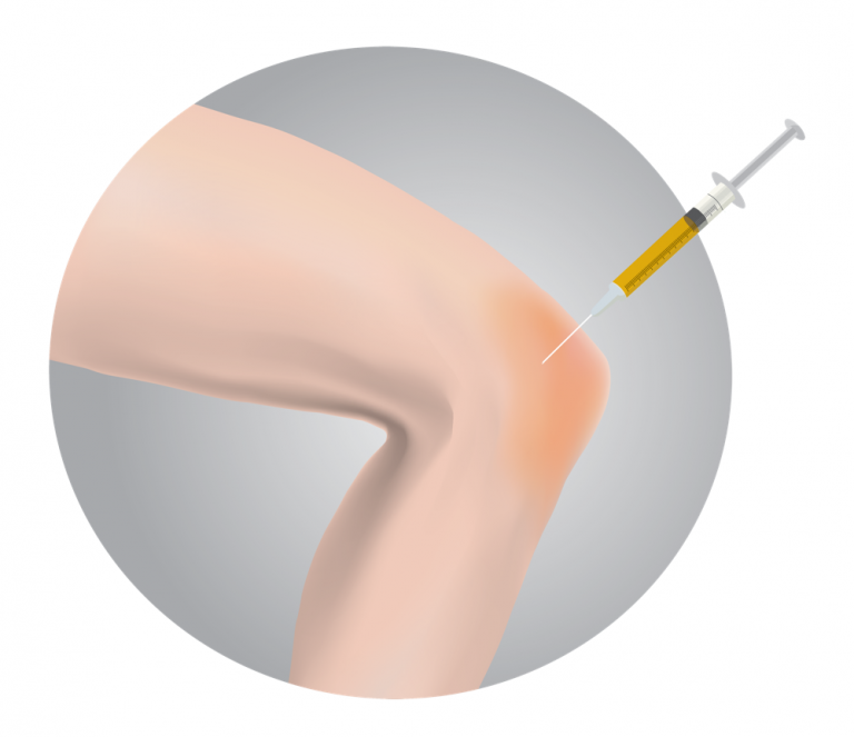 再生医療PRP(PFC－FD)療法【APT整形外科】大府市の整形外科・リウマチ科・リハビリテーション科・内科
